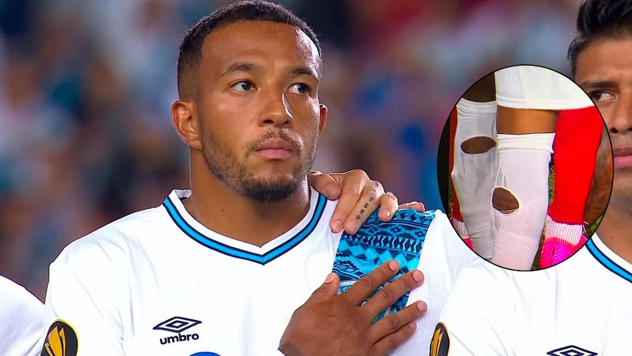 ¿Por qué Nathaniel Méndez-Laing utilizó las medias rotas en su debut ...